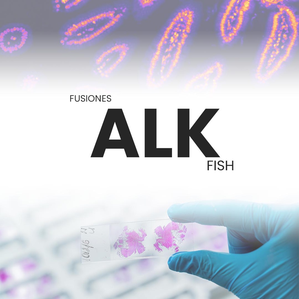 ALK | Nanopharmacia Diagnostica
